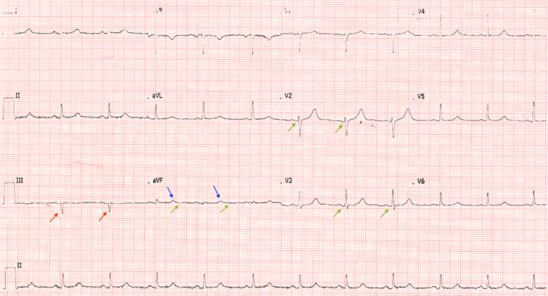 Retraction Watch – Tracking retractions as a window into the scientific ...
