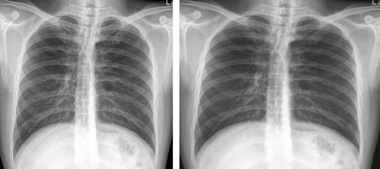 Retraction Watch Tracking Retractions As A Window Into The Scientific Process